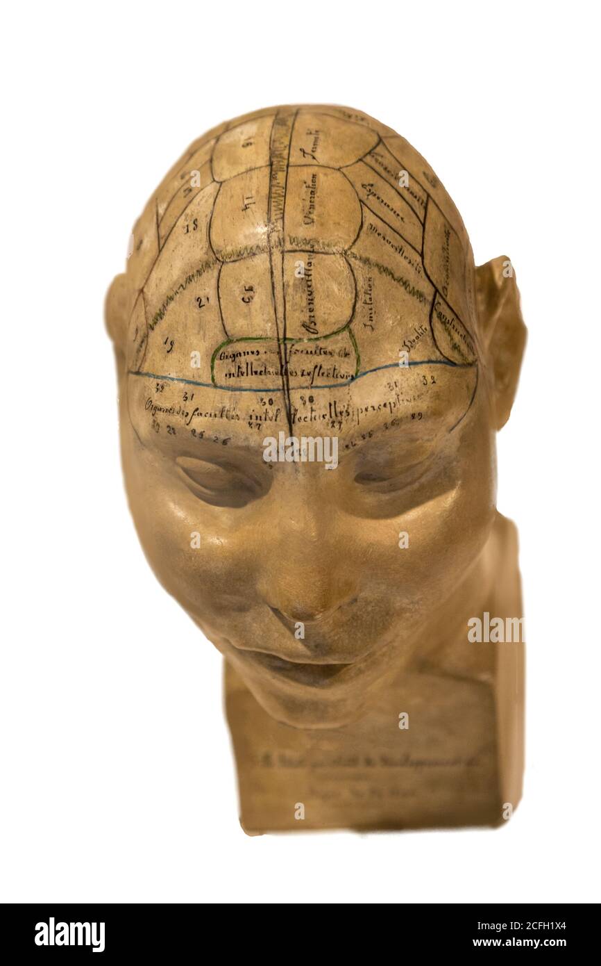 Microcephaly Pinhead Microcephaly Hi Res Stock Photography And Images