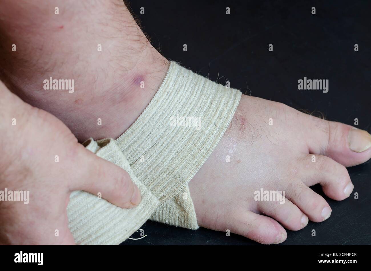 Human shin bone hi-res stock photography and images - Alamy