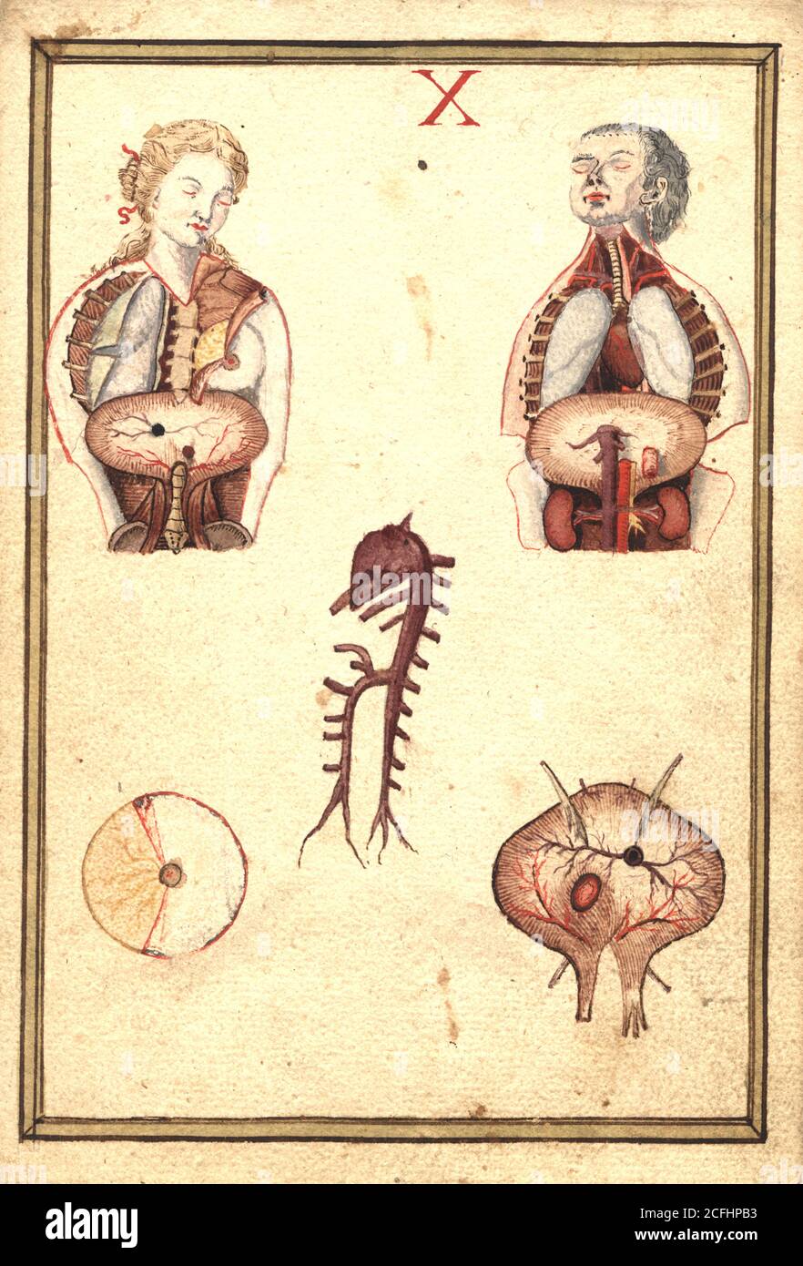 Damaged organs hi-res stock photography and images - Alamy