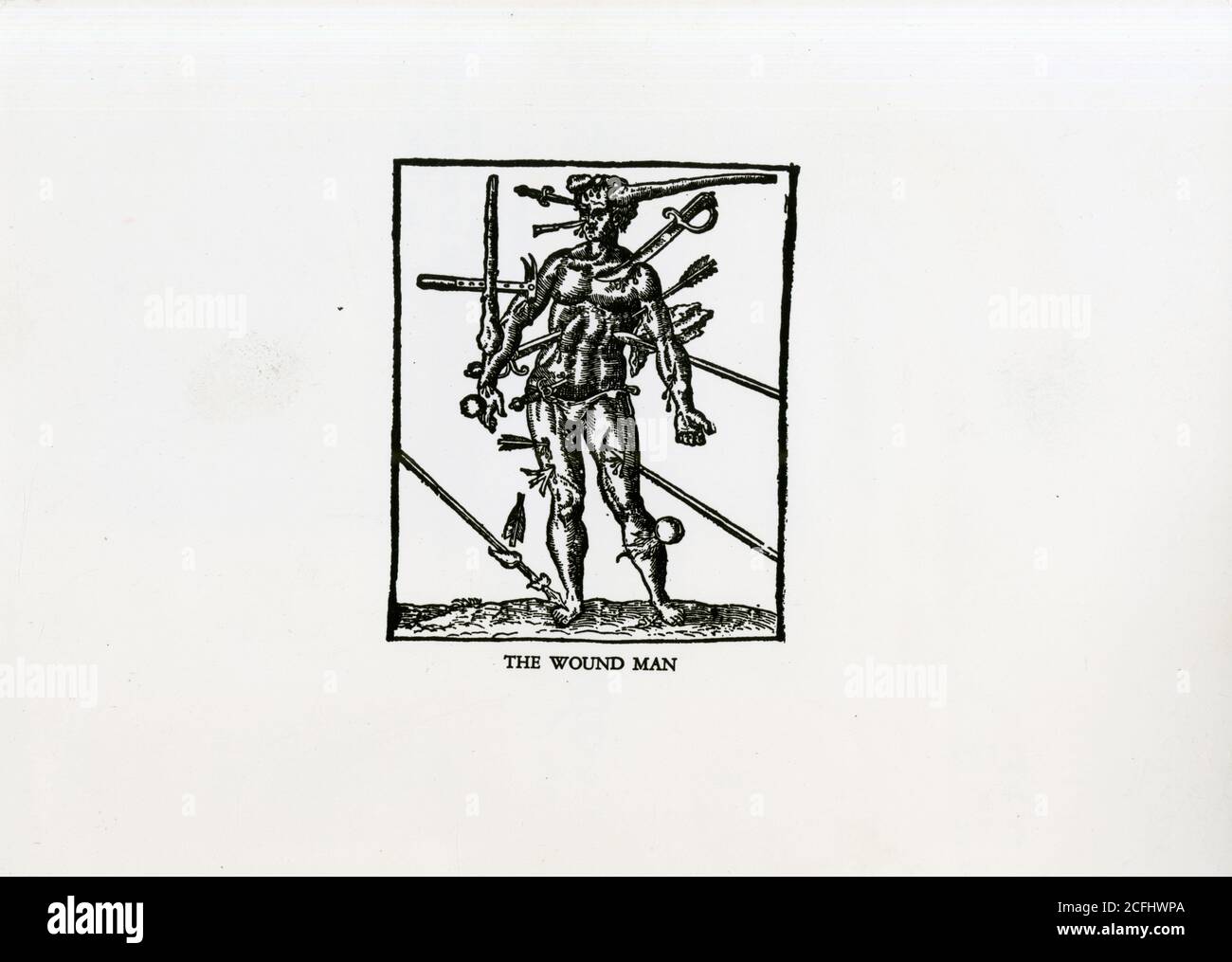 Wound Man High Resolution Stock Photography and Images - Alamy