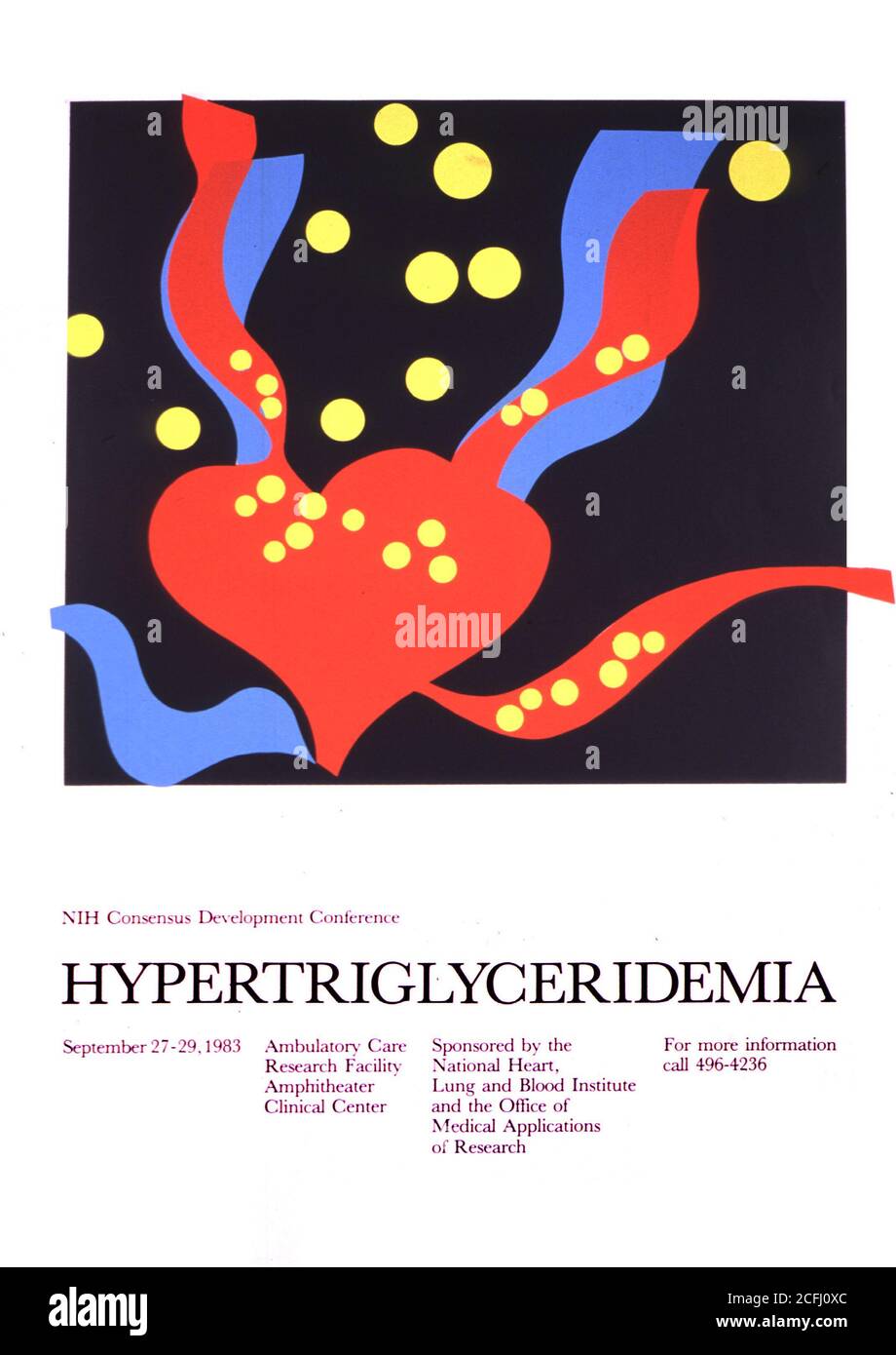 Hypertriglyceridemia hi-res stock photography and images - Alamy