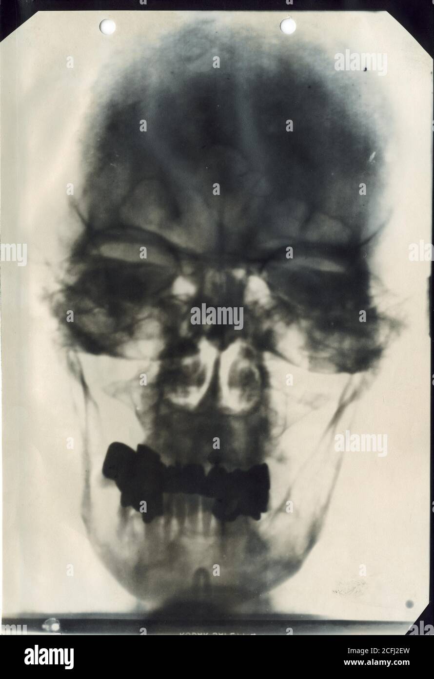 1940s x ray hi-res stock photography and images - Alamy
