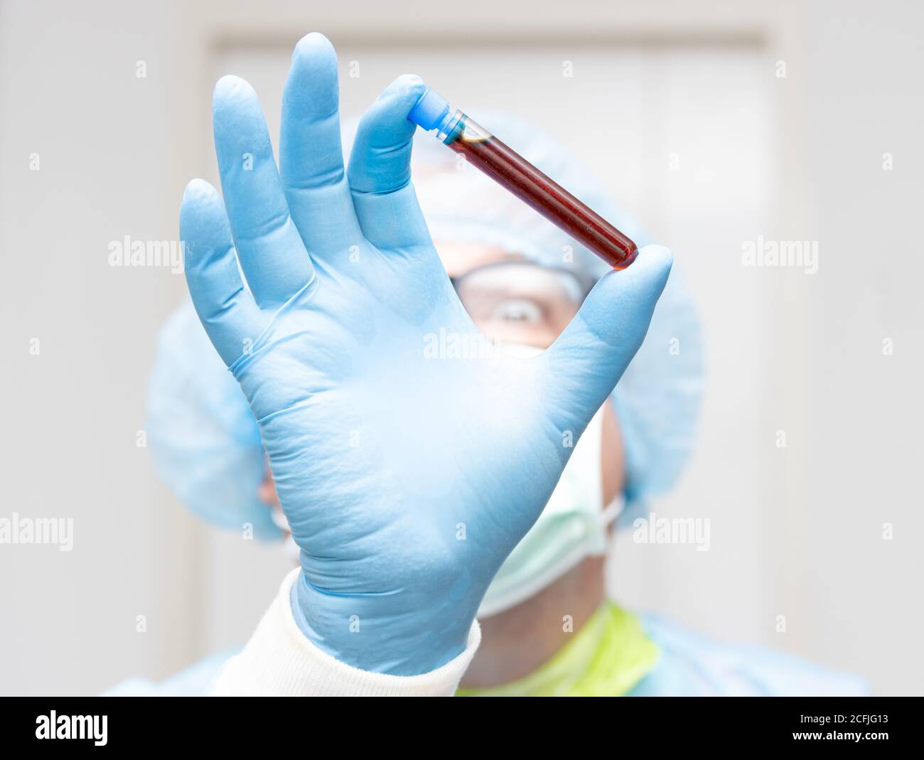 The doctor hold test tube with a testing blood, focus on a hand ...