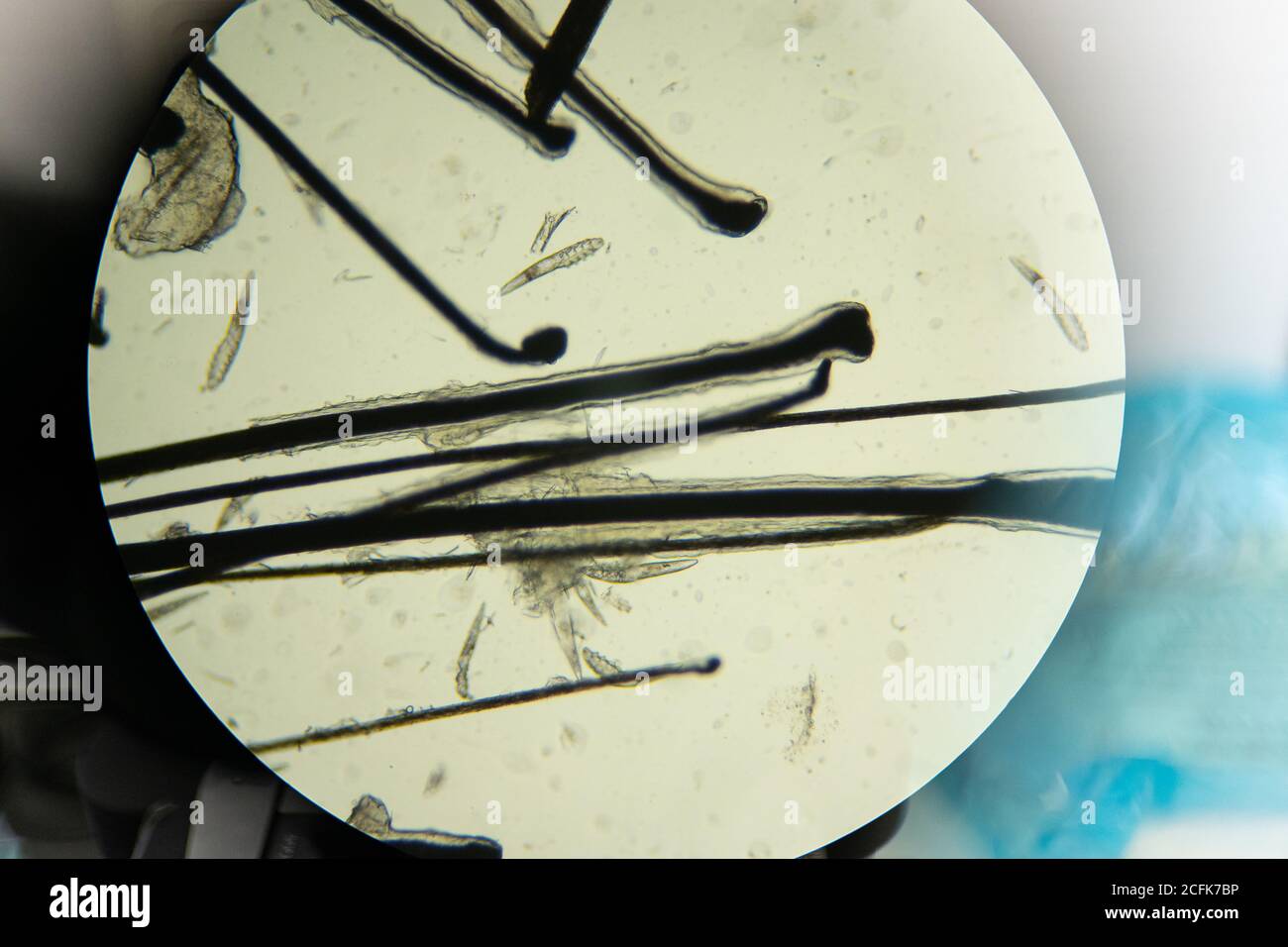 Parasites microscope hi-res stock photography and images - Alamy