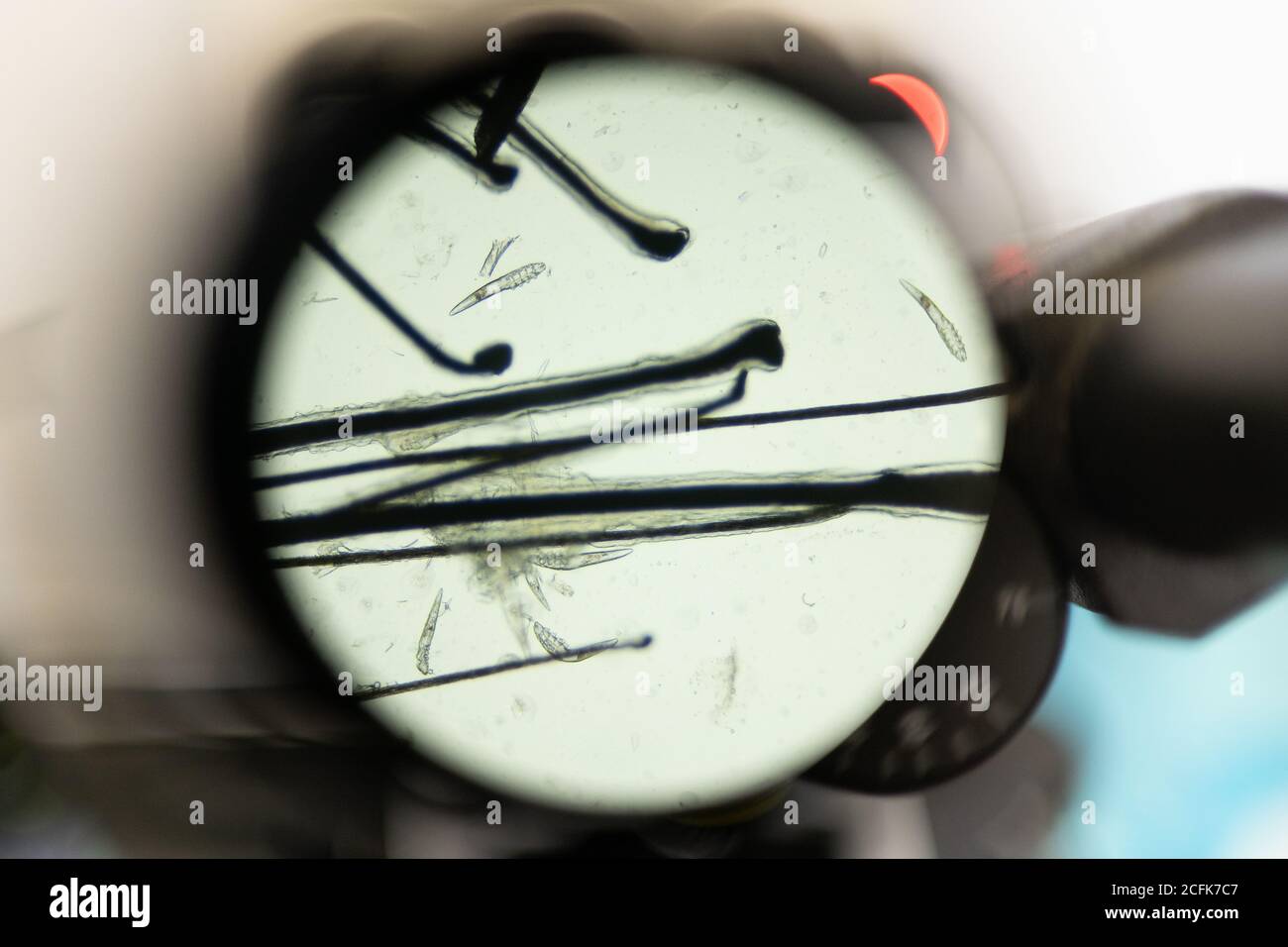 Parasites microscope hi-res stock photography and images - Alamy