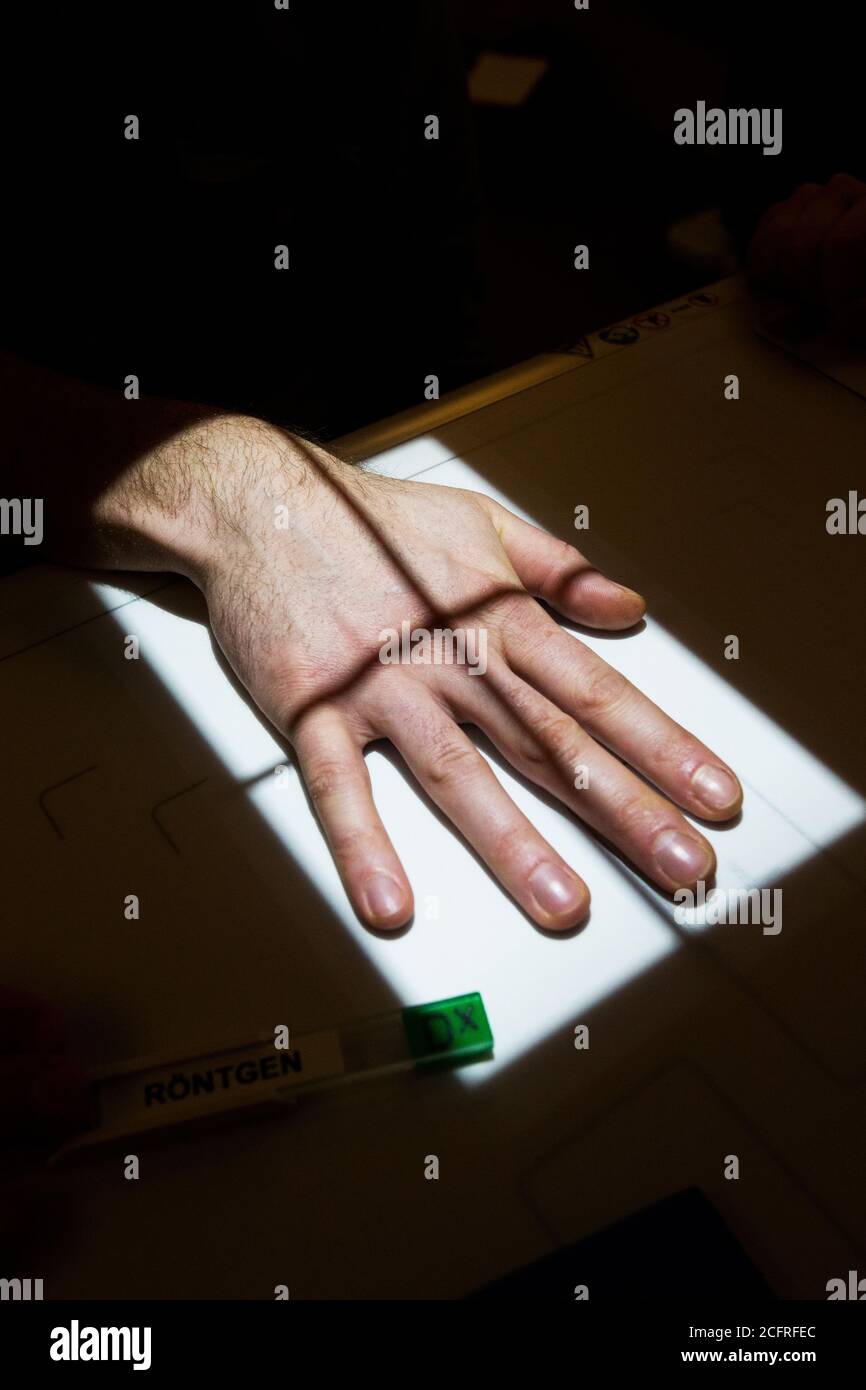 Norrköping, Sweden 2017 Hand x-rayed in a hospital. Photo Jeppe ...