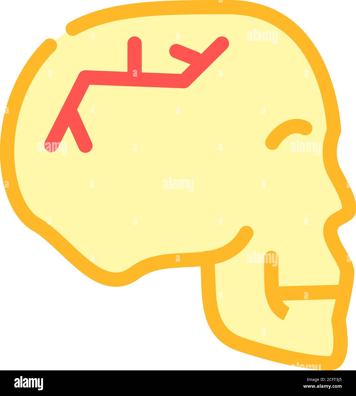 skull fracture color icon vector isolated illustration Stock Vector ...