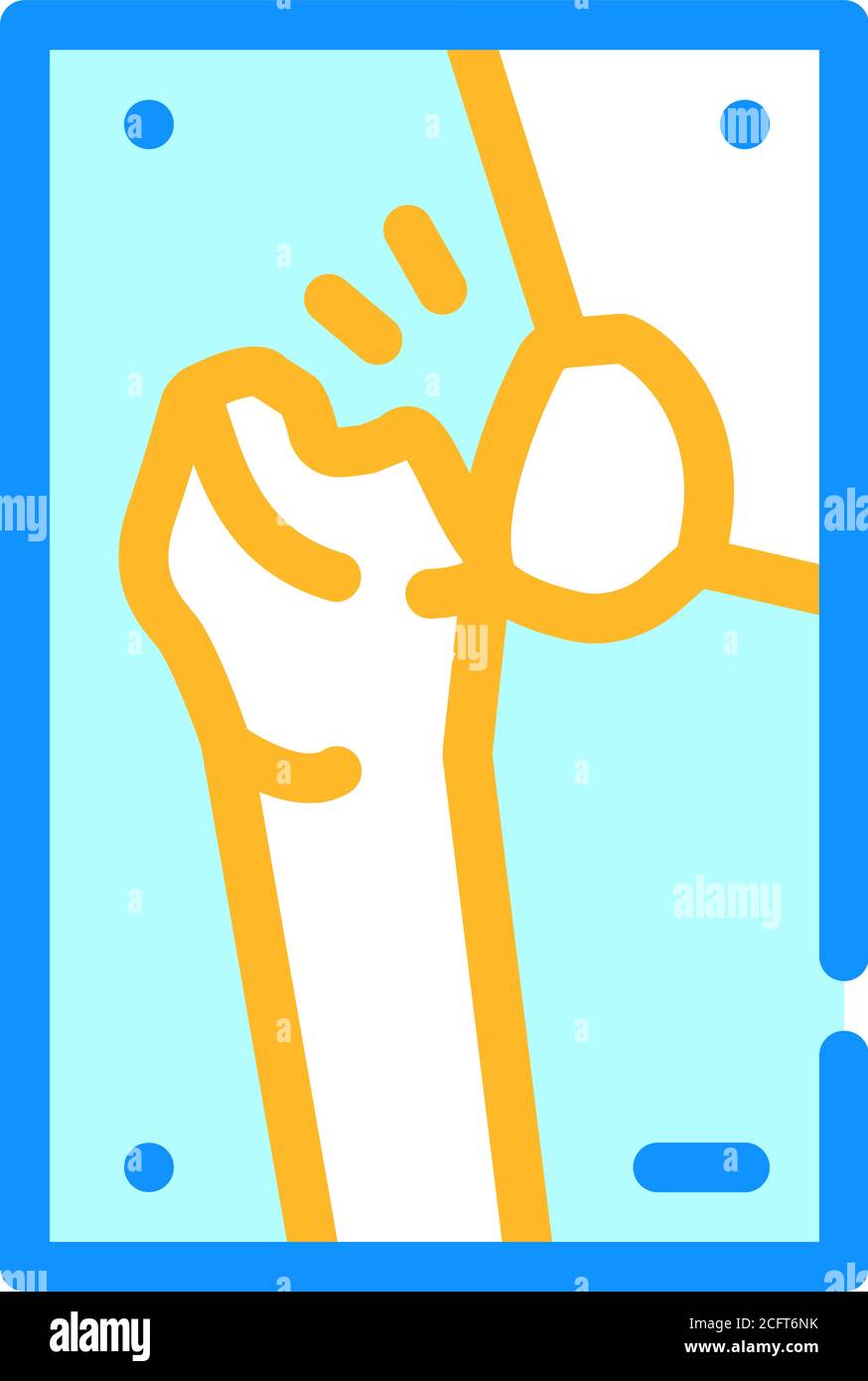hip fracture x-ray color icon vector illustration Stock Vector Image ...