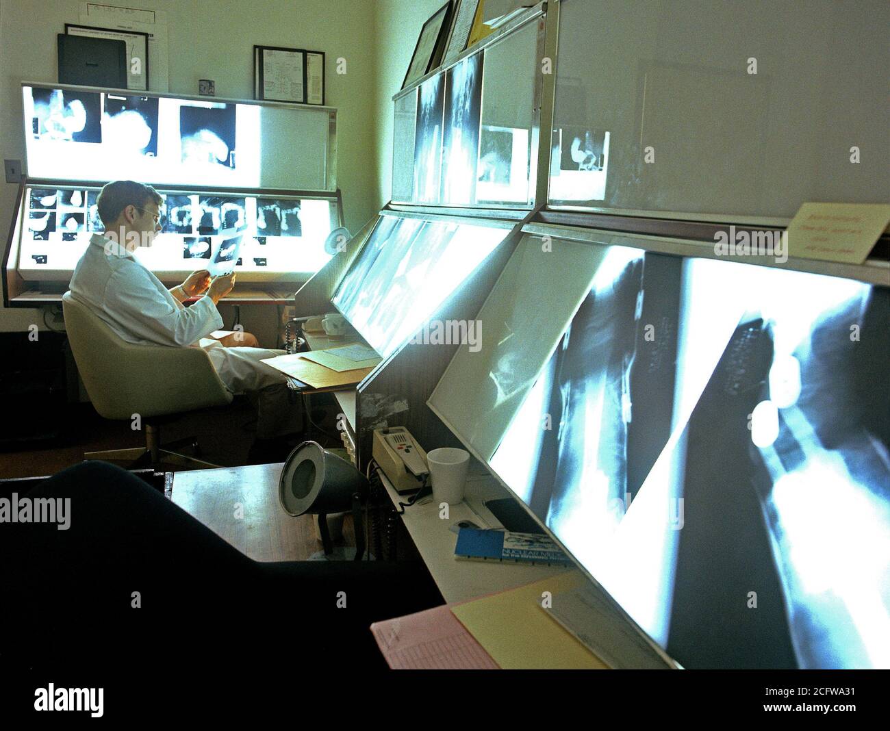 1970s doctor examines x rays hi-res stock photography and images - Alamy