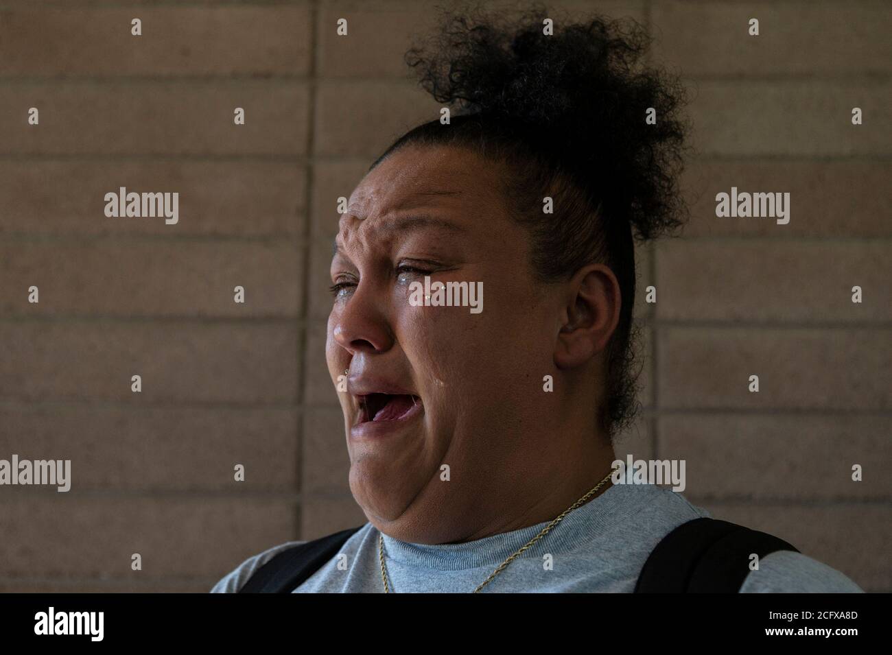 Child hospital before after hi-res stock photography and images - Alamy