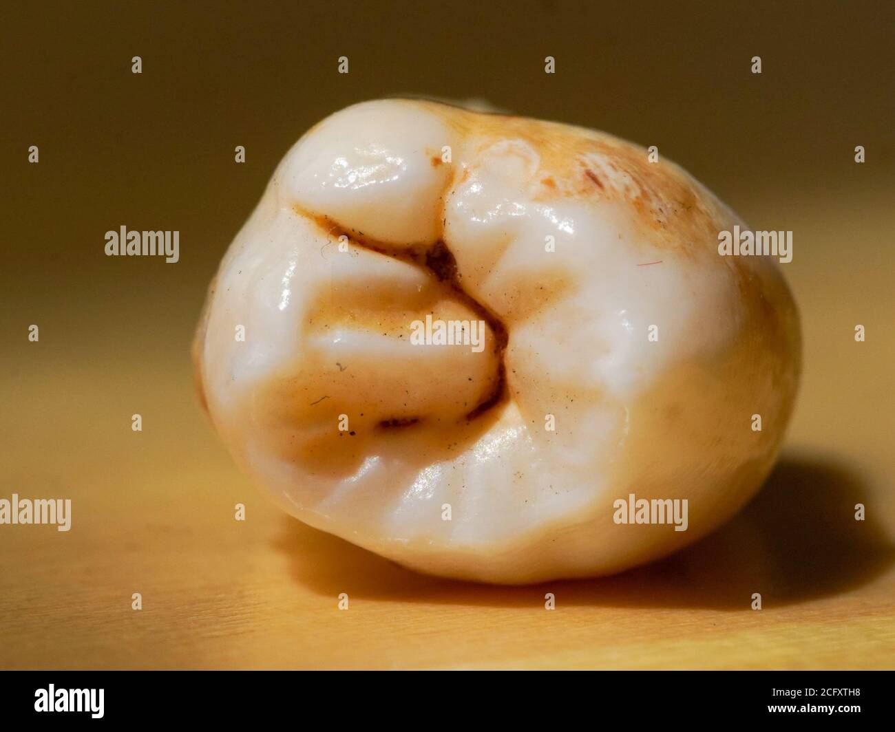 Prevention of tooth decay hi-res stock photography and images - Alamy
