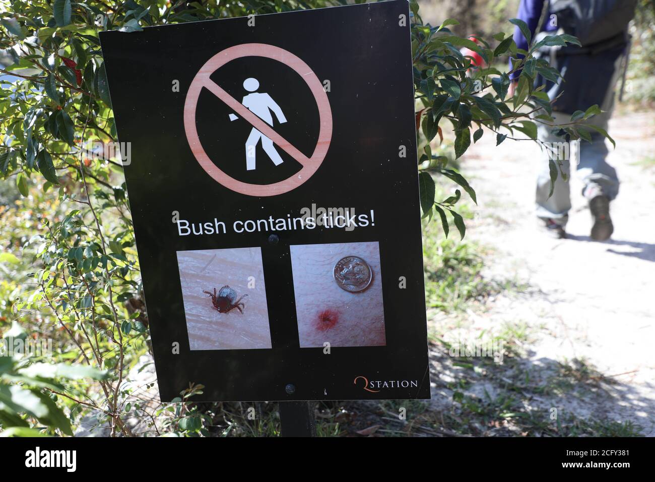 A sign warning about ticks in the bush and tick bites next to a trail ...