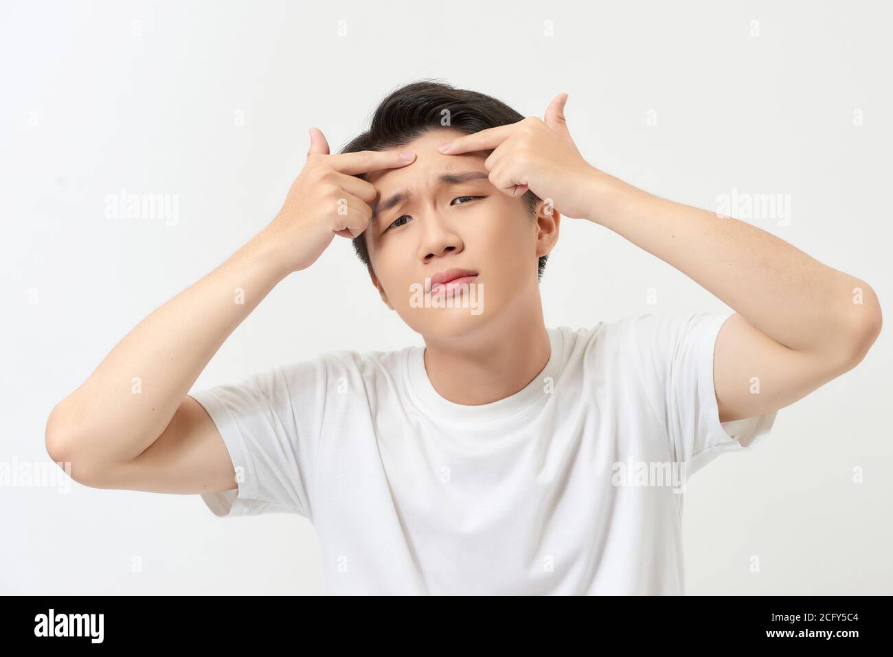 Man skin care concept. Acne spot pimple spot skincare beauty care male ...