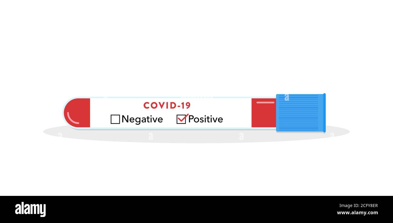 Test tube for coronavirus diagnosis. Covid-19 test. Positive result ...