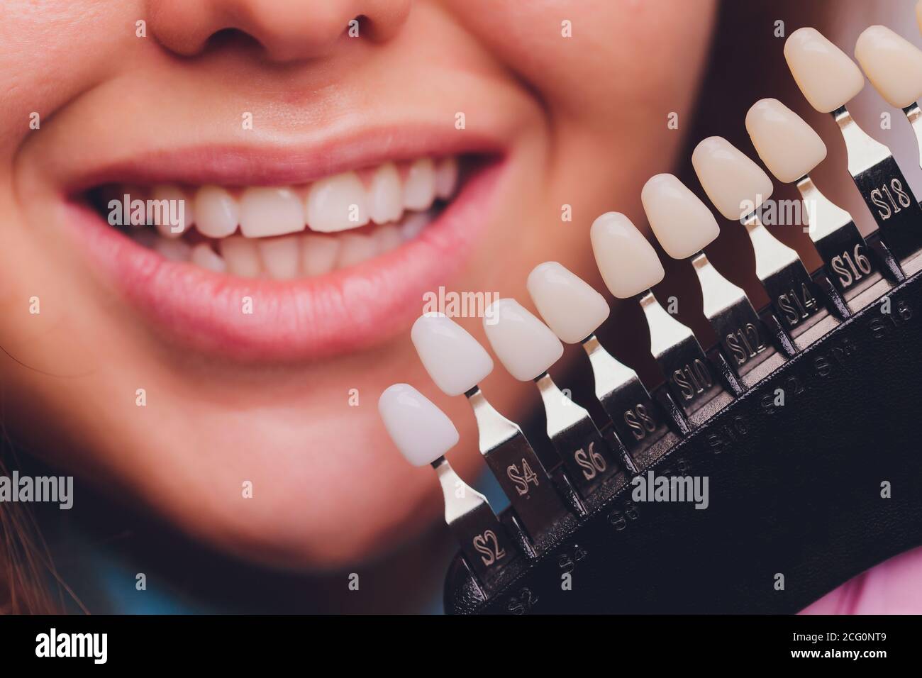 The dentist comparing patient's teeth shade with samples for bleaching ...