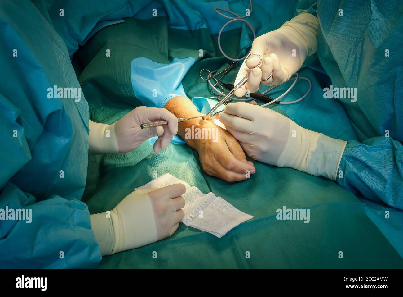 a plastic surgeon performs hand surgery on a patient in an operating ...