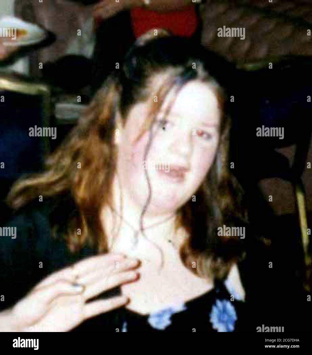 BEST QUALITY AVAILABLE: Undated collect picture of Leukaemia sufferer ...