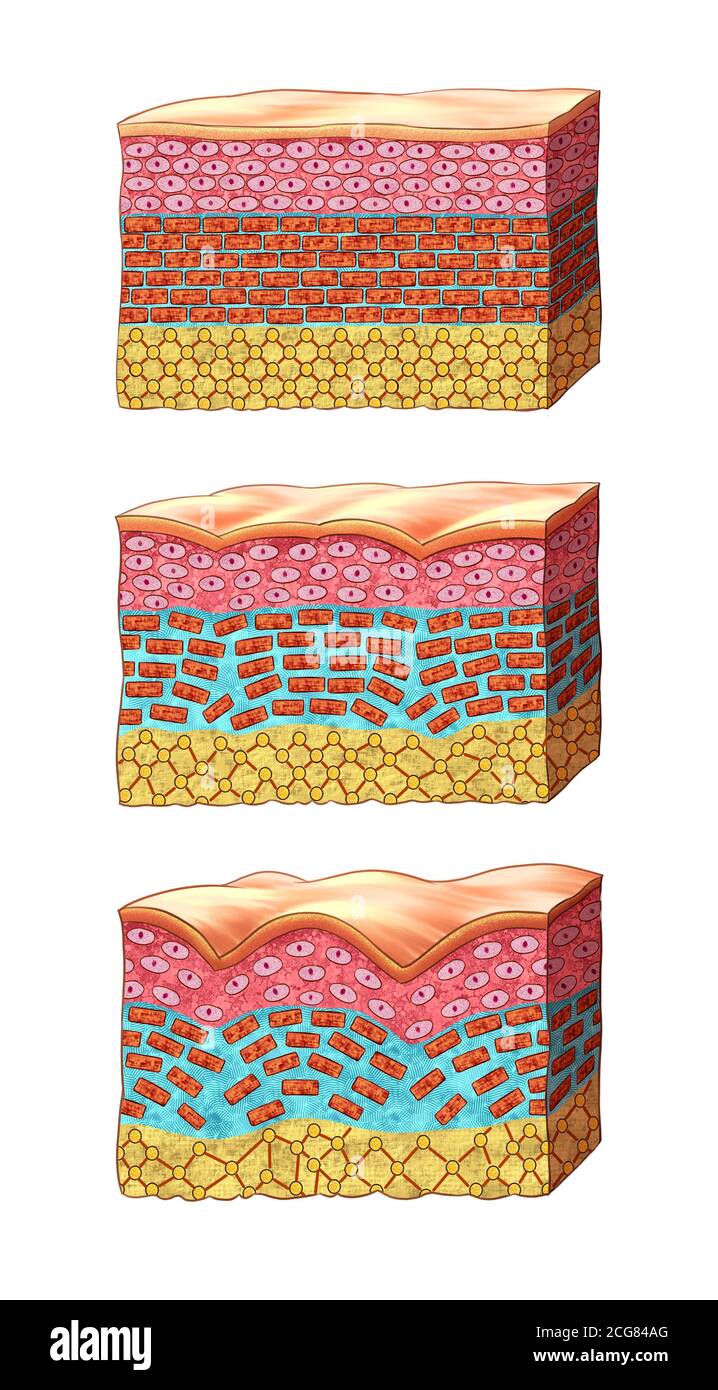 Human skin cutaway diagram Cut Out Stock Images & Pictures - Alamy