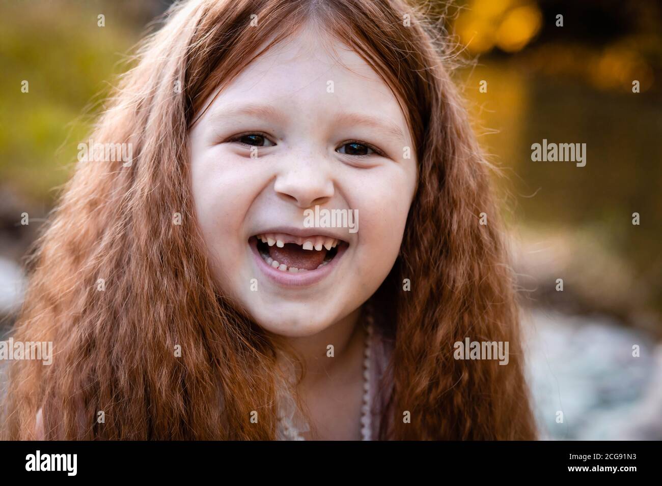 Little Girl With Front Teeth Missing High Resolution Stock Photography ...