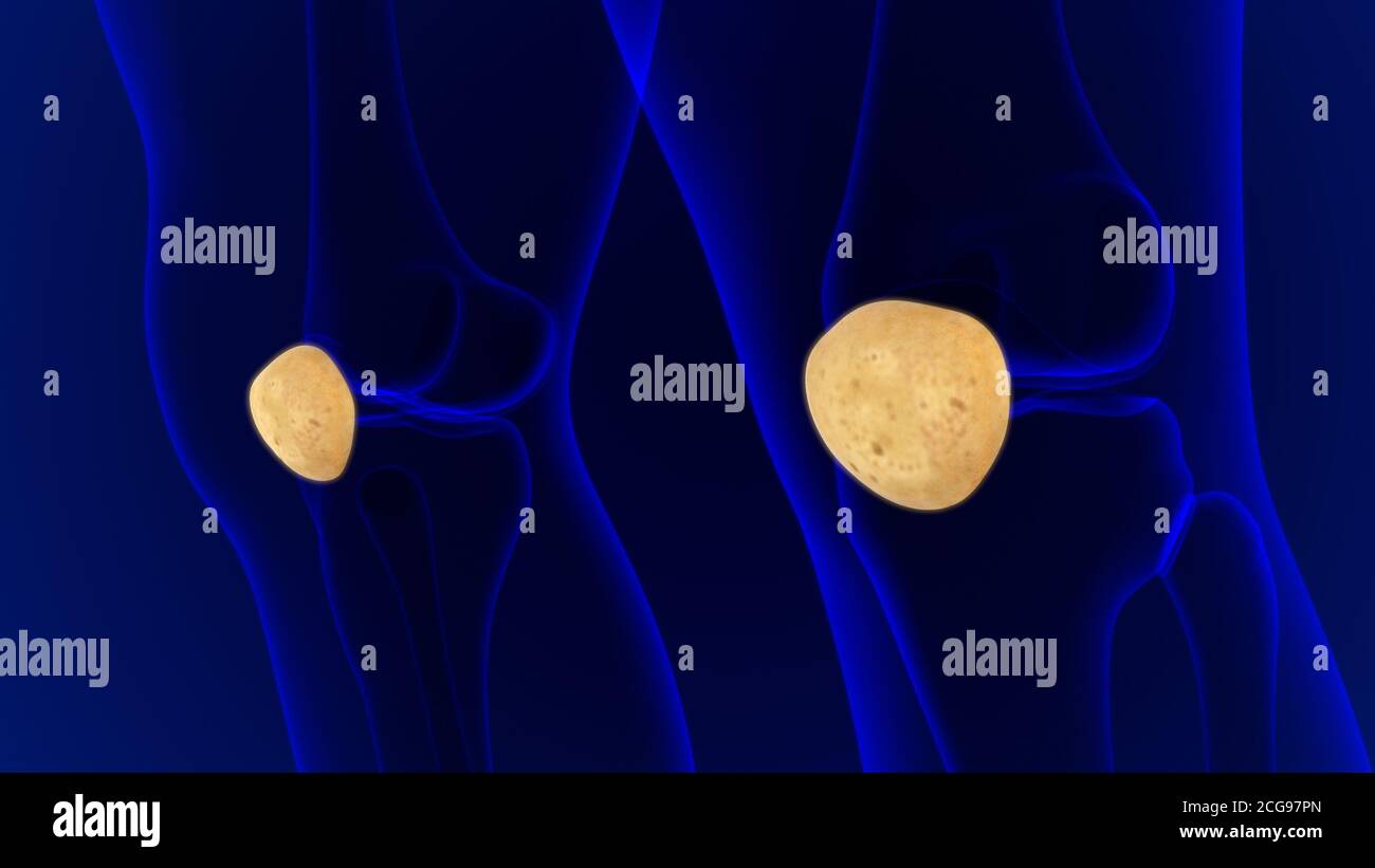 Human skeleton anatomy Patella Bone 3D Rendering For Medical Concept ...