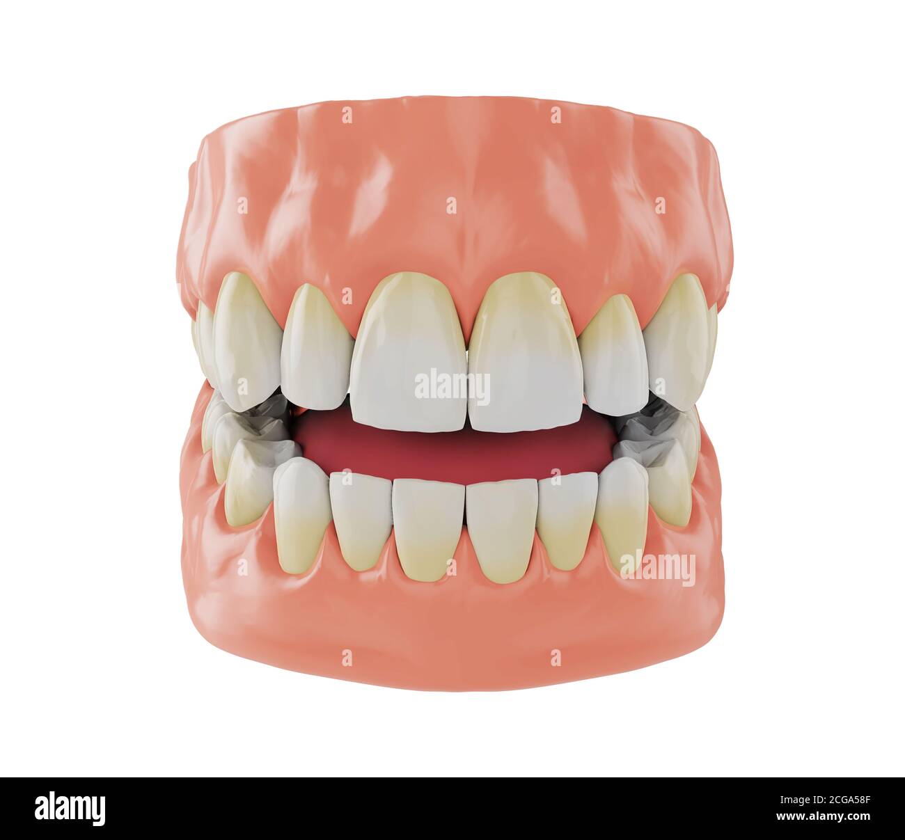 Correct the bite Cut Out Stock Images & Pictures - Alamy