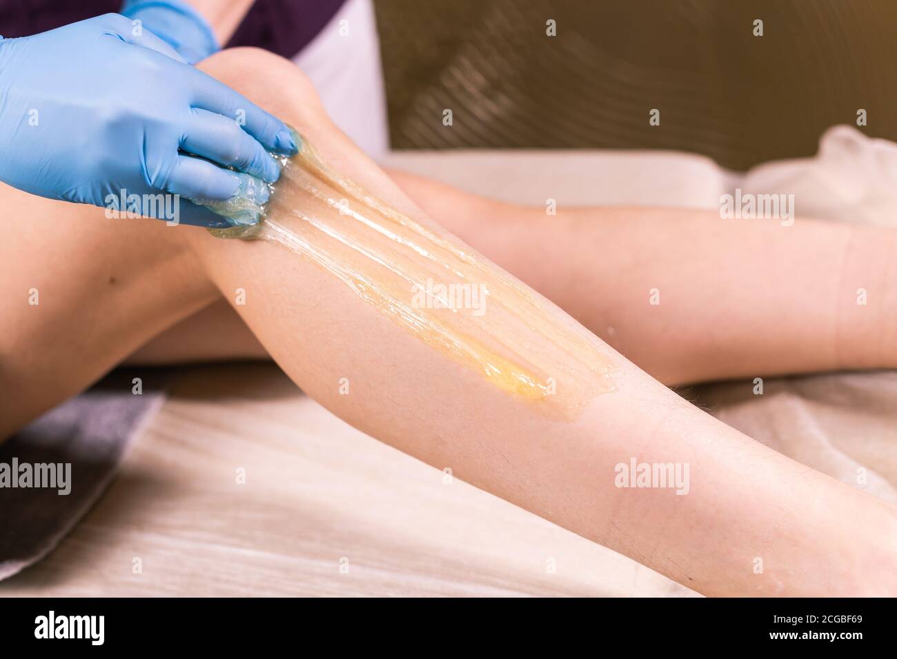 Sugaring epilation with liquid sugar at legs close-up. Cosmetology and ...