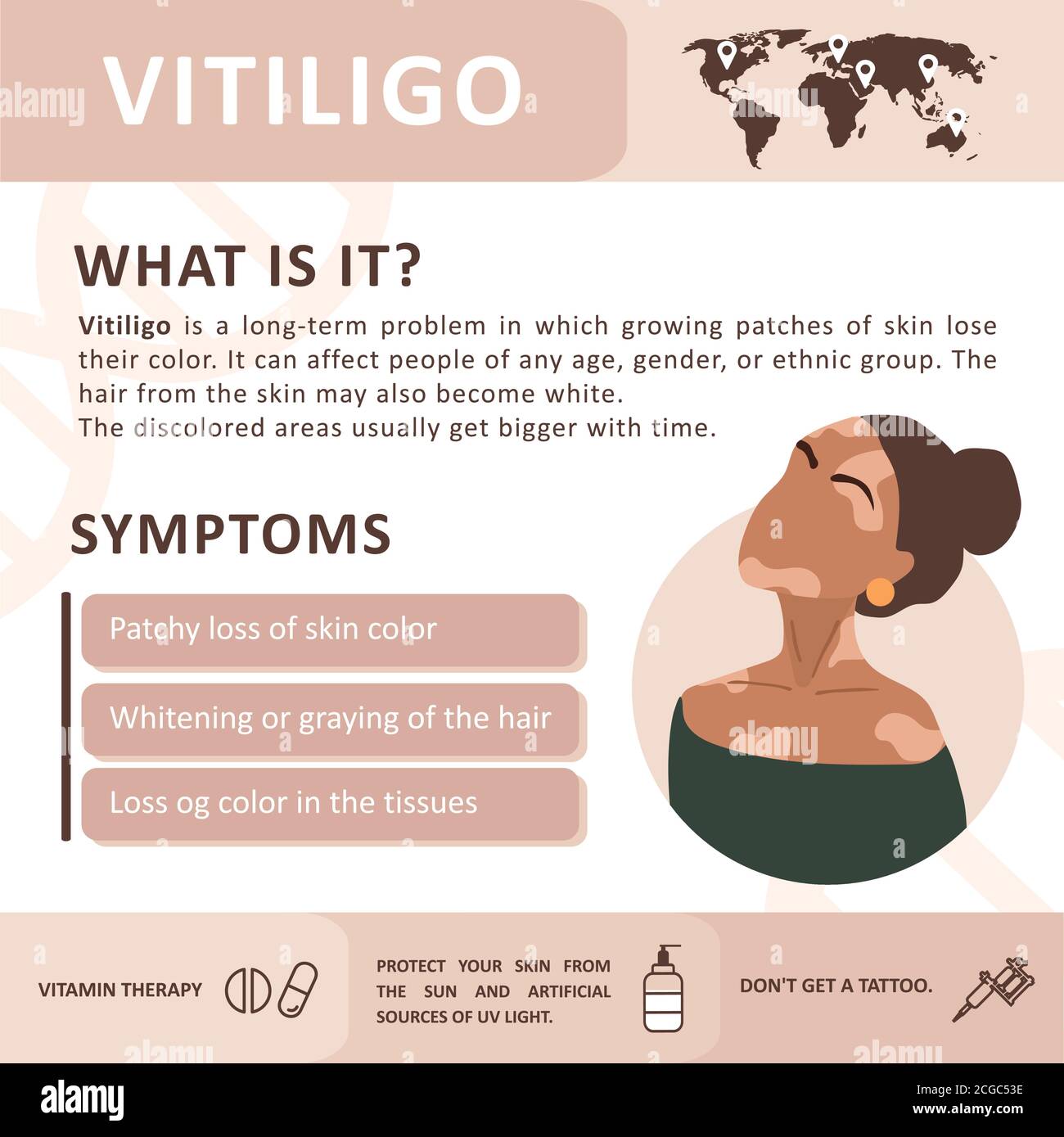 Infographics of vitiligo. Symptoms of the disease. Abstract woman ...