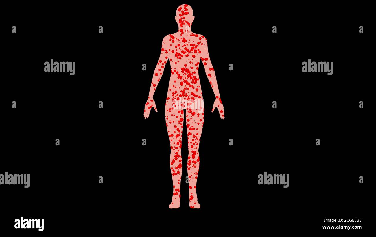 Outline of female body with red dots , spheres. Viruses, germs ...