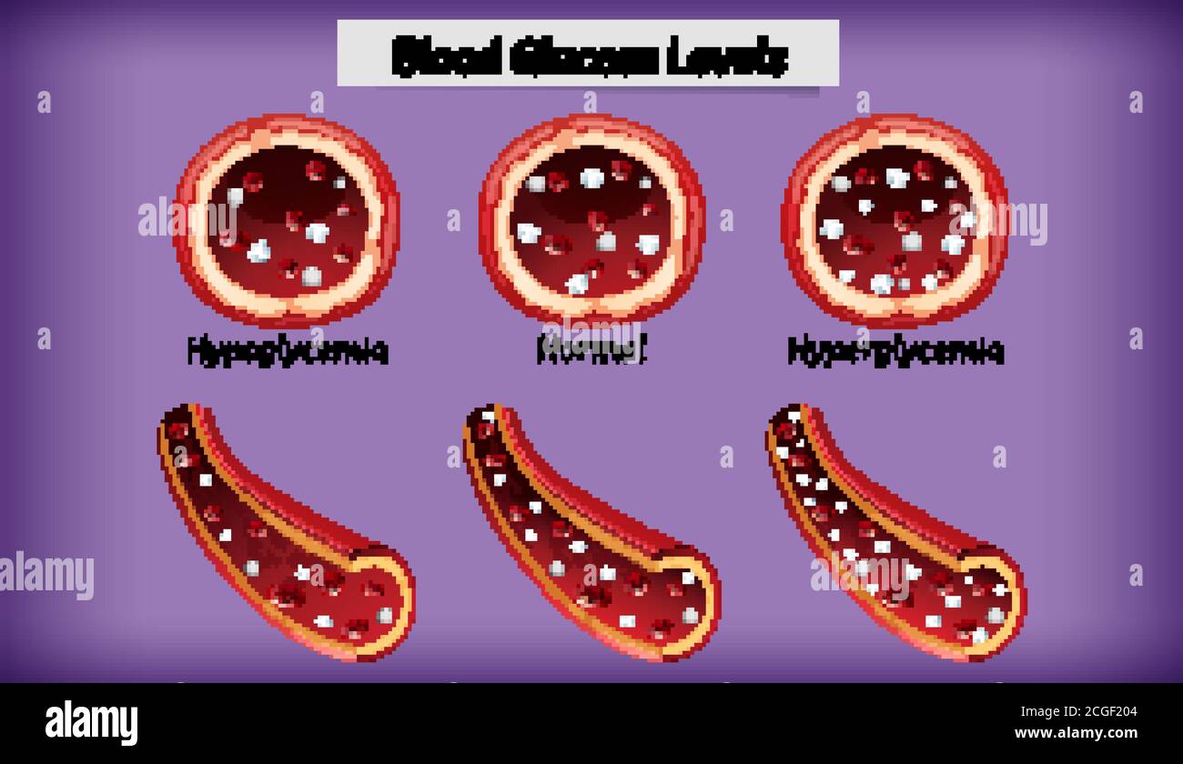 Medical blood glucose level illustration Stock Vector Image & Art - Alamy