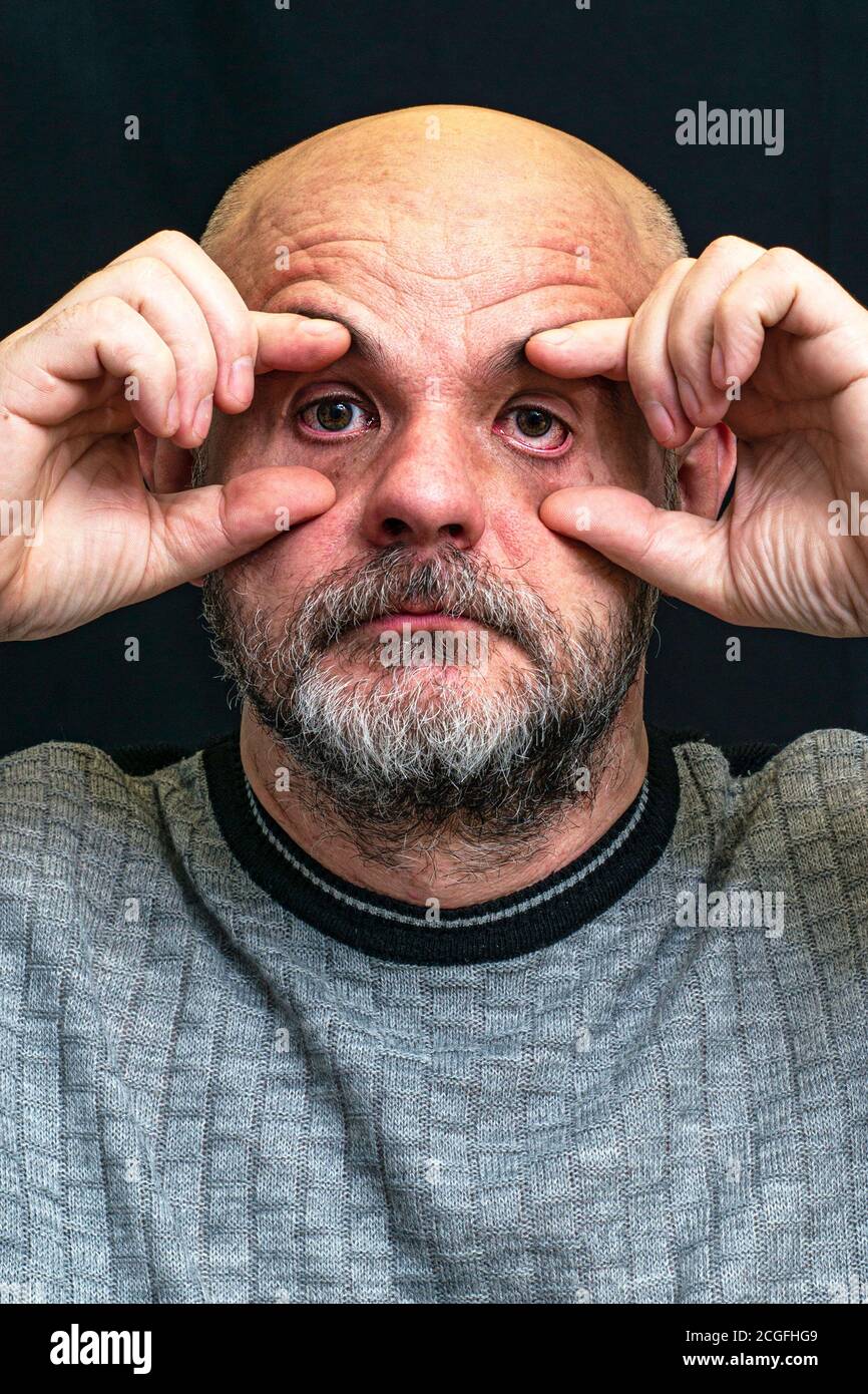 Eyes apart hi-res stock photography and images - Alamy