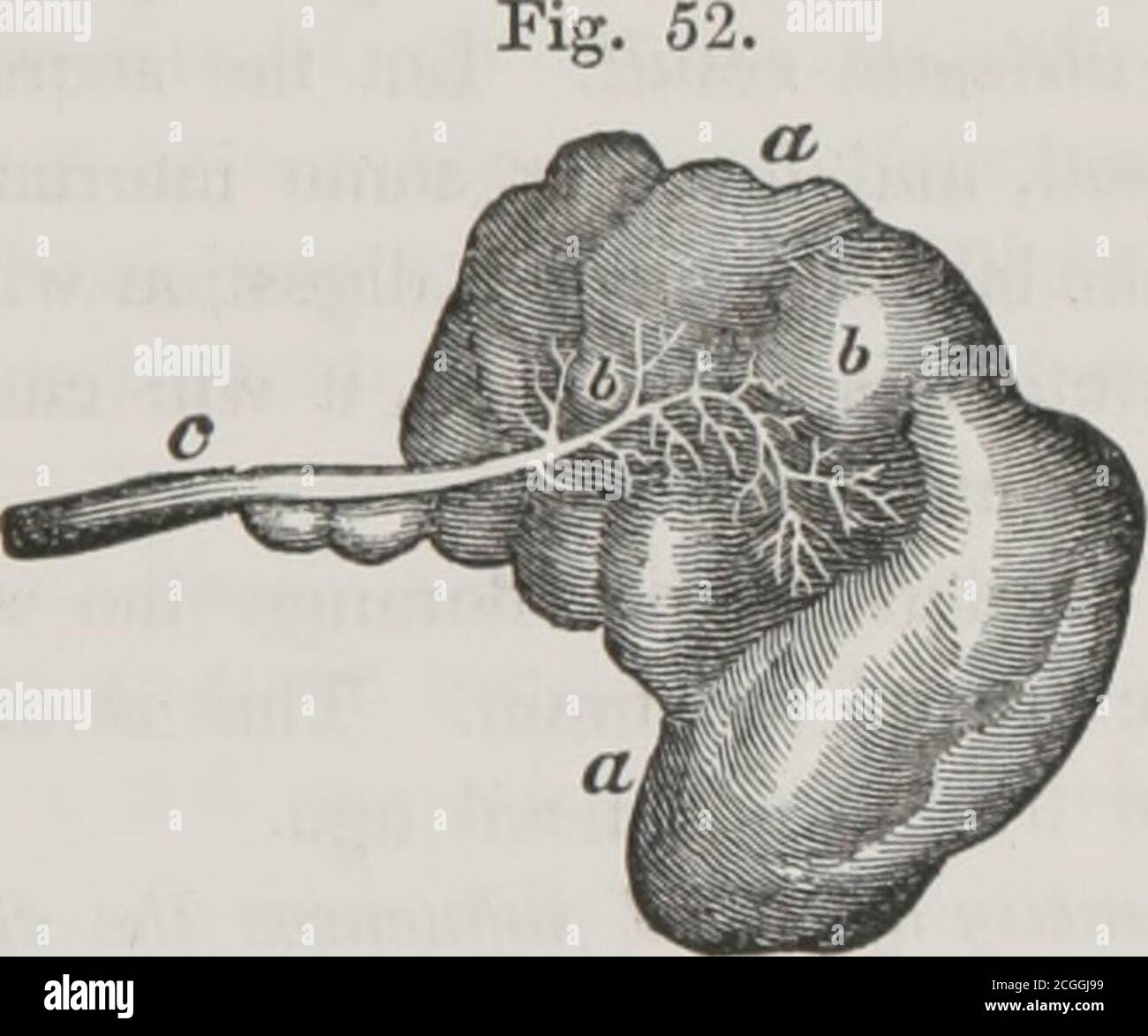Wound secretion hi-res stock photography and images - Alamy
