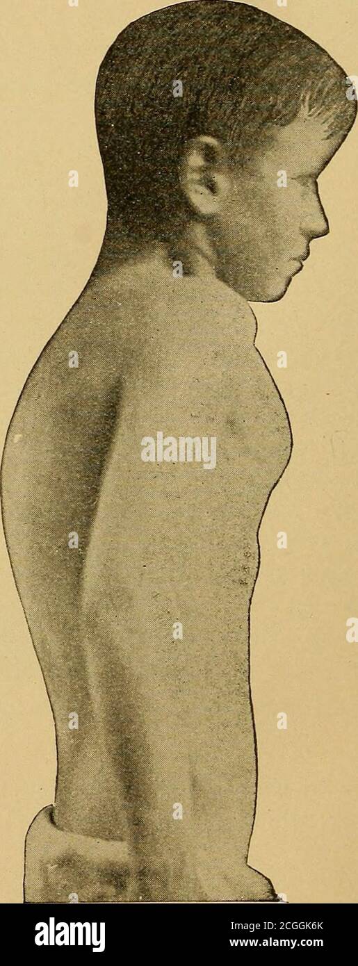 Bulging chest hi-res stock photography and images - Alamy