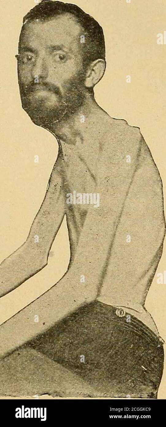 . Physical diagnosis . der unreliable the usual bony landmarks, with ...