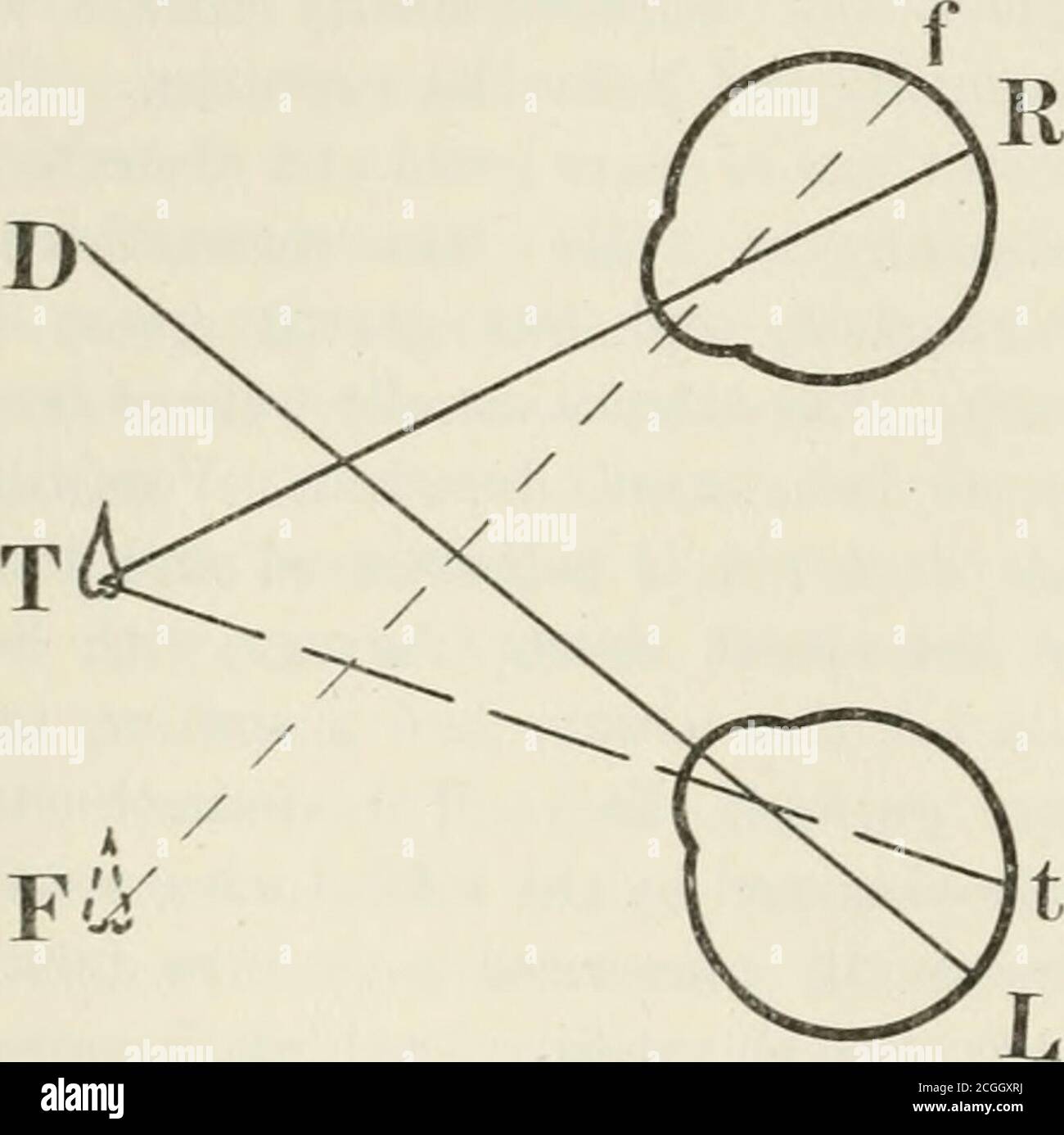 Hyperchlorhydria hi-res stock photography and images - Alamy