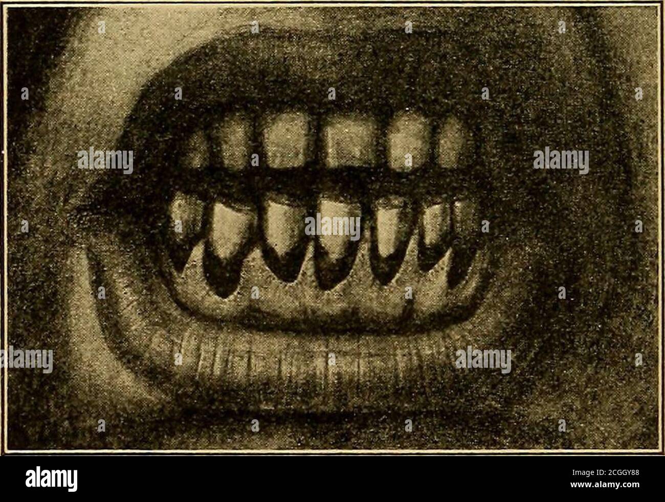 Geographic tongue hi-res stock photography and images - Alamy