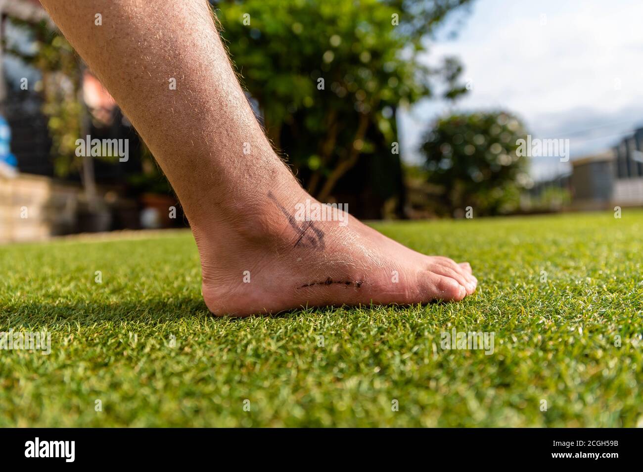 Home scar hi-res stock photography and images - Alamy