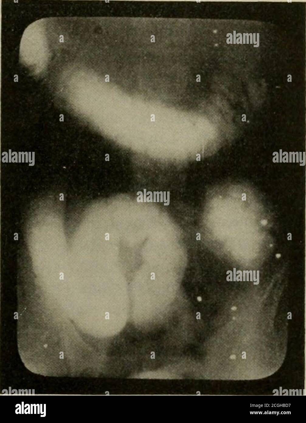 . Hospital Bulletin . method of diagnosing Intestinal Stasis, while val ...