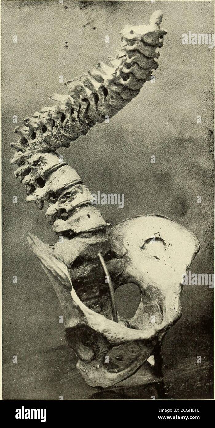 . Bulletin of the Warren Anatomical Museum . 1371. Vertebrae ...