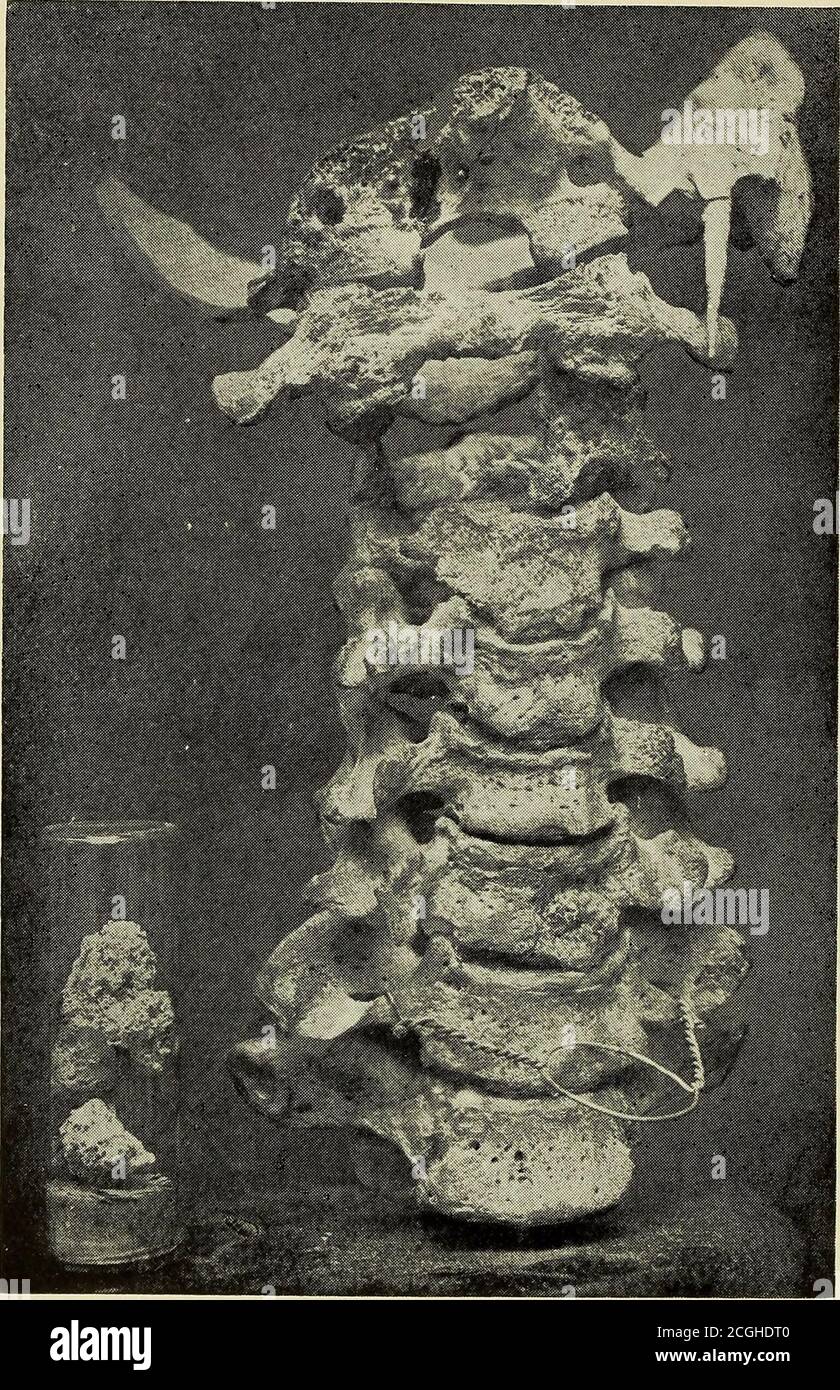 . Bulletin of the Warren Anatomical Museum . 0. B. Fifield 10156. Tibia ...