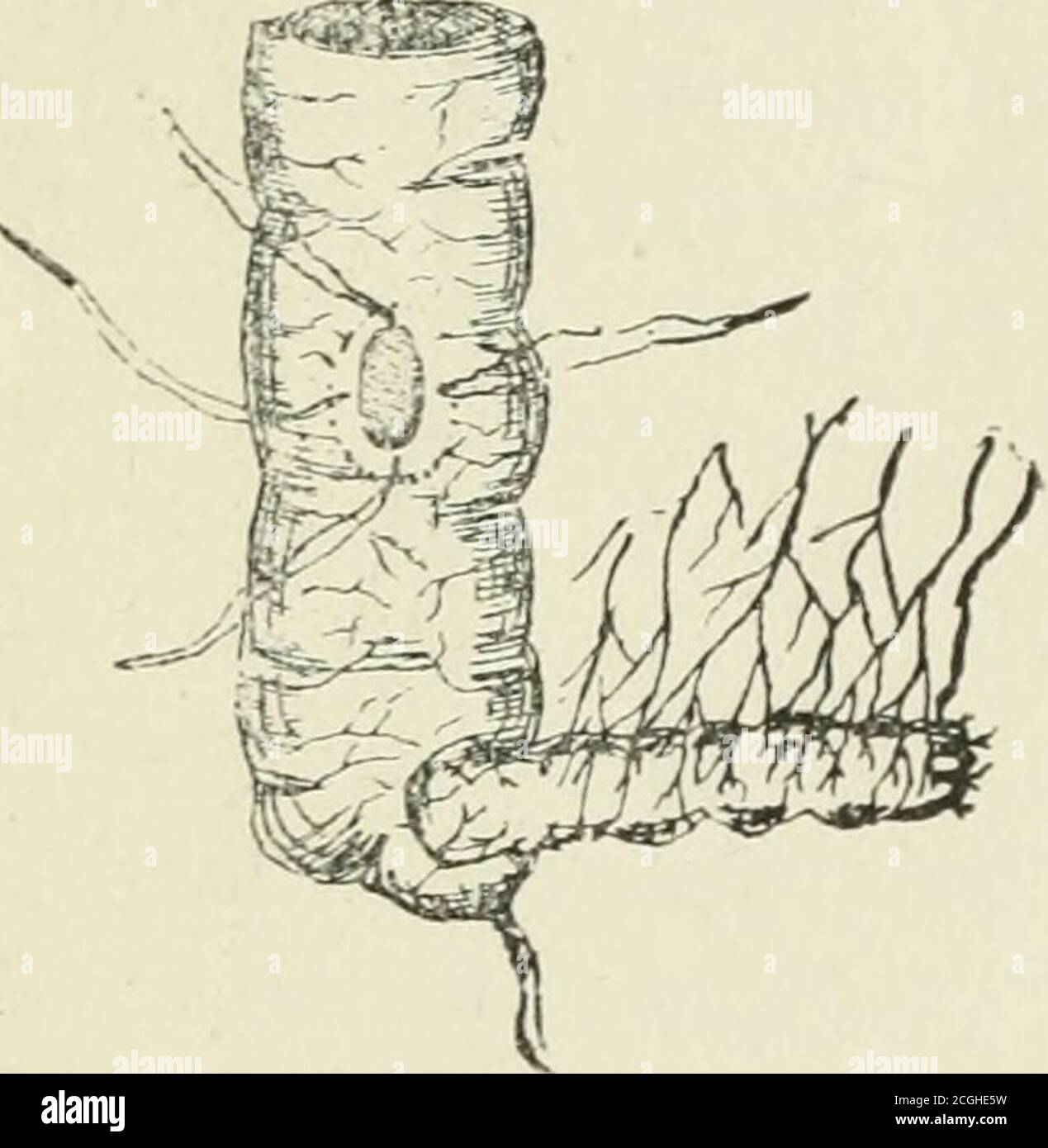 . Annals of surgery . Intestinal Anastomosis by Perforated Decalcified ...