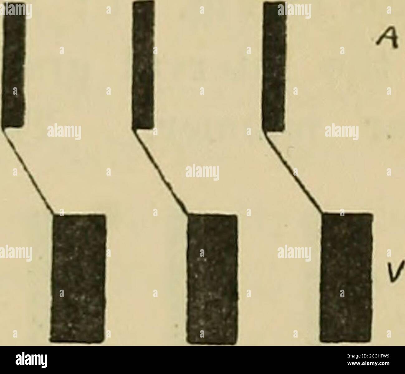 . Clinical disorders of the heart beat : a handbook for practitioners ...
