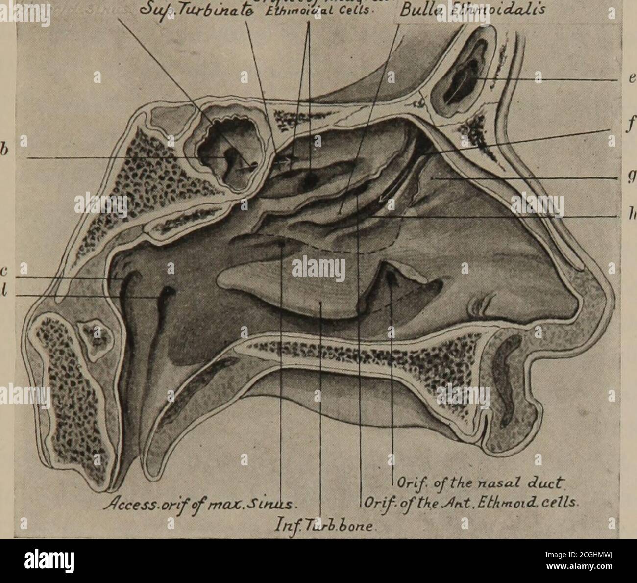 Choanal Anatomy
