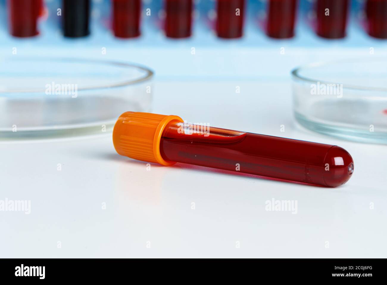 Blood sample tubes medical equipment close up Stock Photo - Alamy