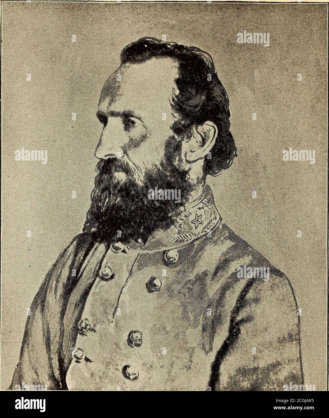 Stonewall Jackson Amputation