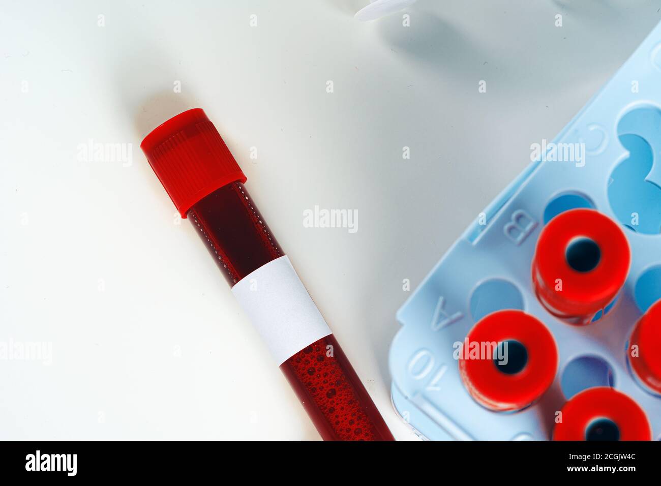 Blood sample tubes medical equipment close up Stock Photo - Alamy