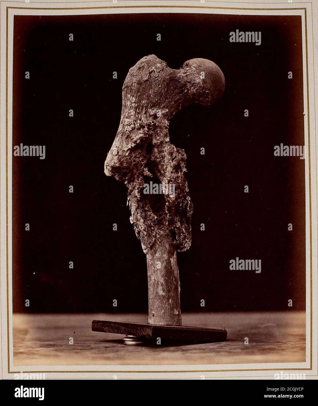 . Photographs of surgical cases and specimens . -lateralflap operation ...