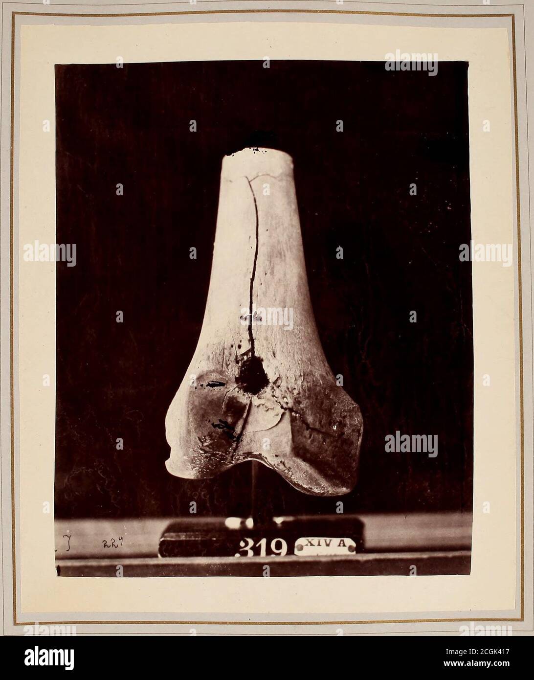 . Photographs of surgical cases and specimens . ummits, wereevidently ...