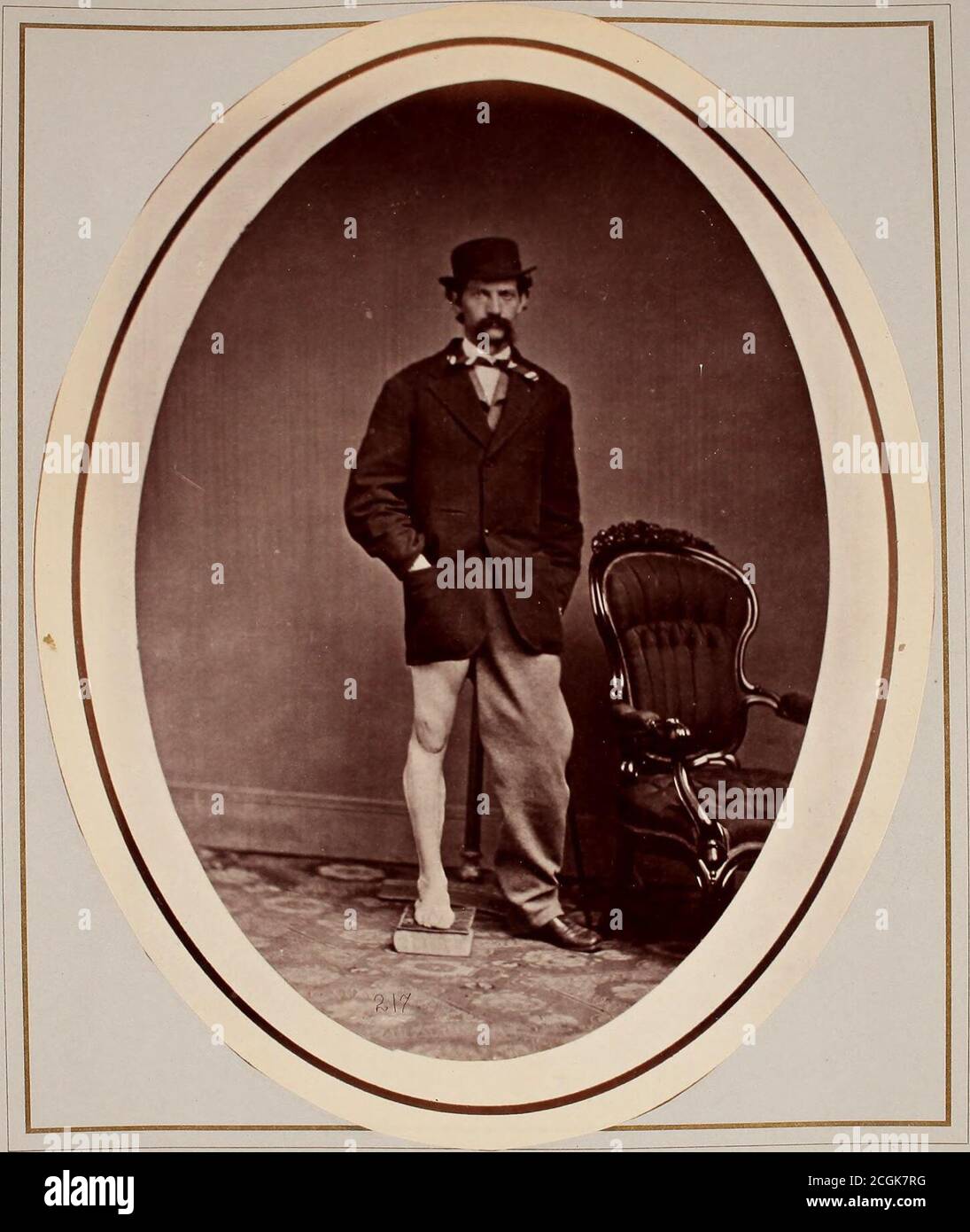 . Photographs of surgical cases and specimens . of the Surgical Section ...