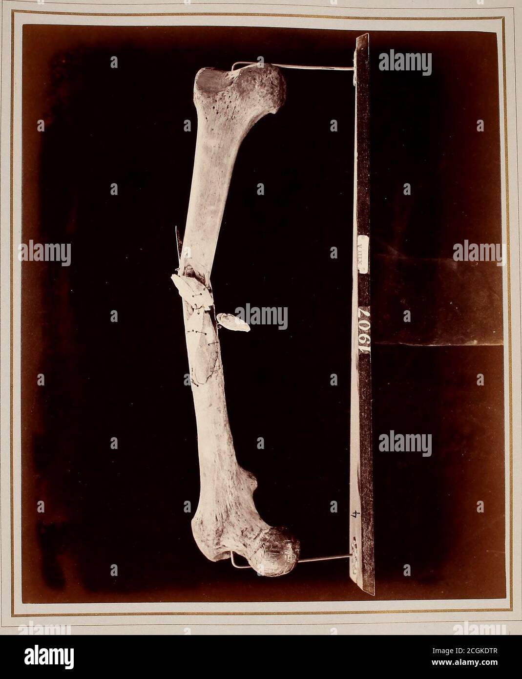 . Photographs of surgical cases and specimens . MUSEUM. Photograph No ...