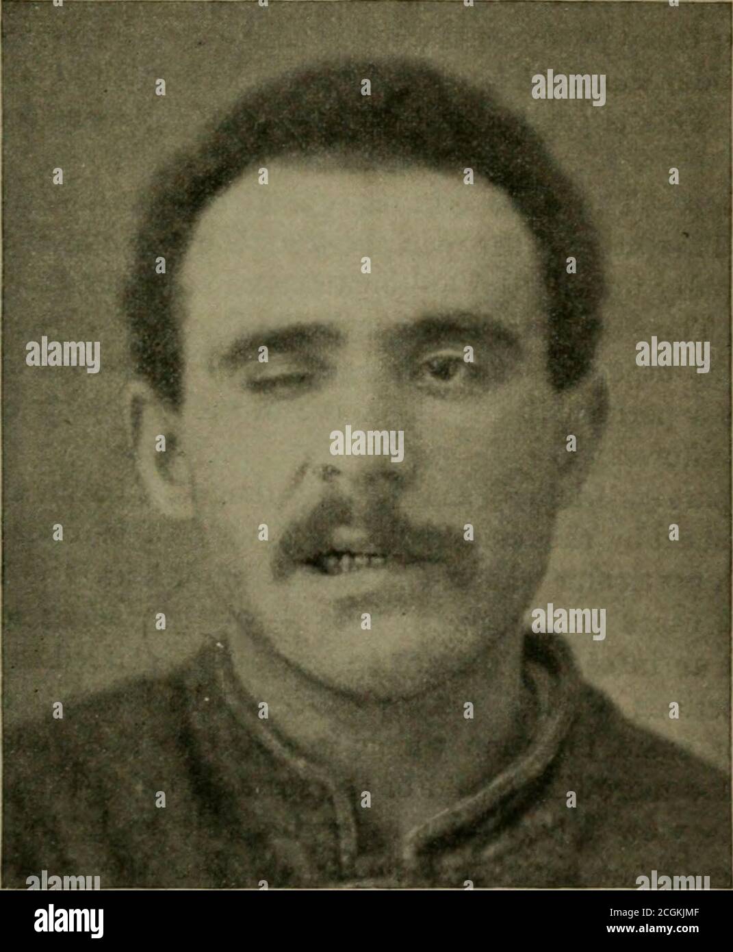 Stapedius muscle hi-res stock photography and images - Alamy